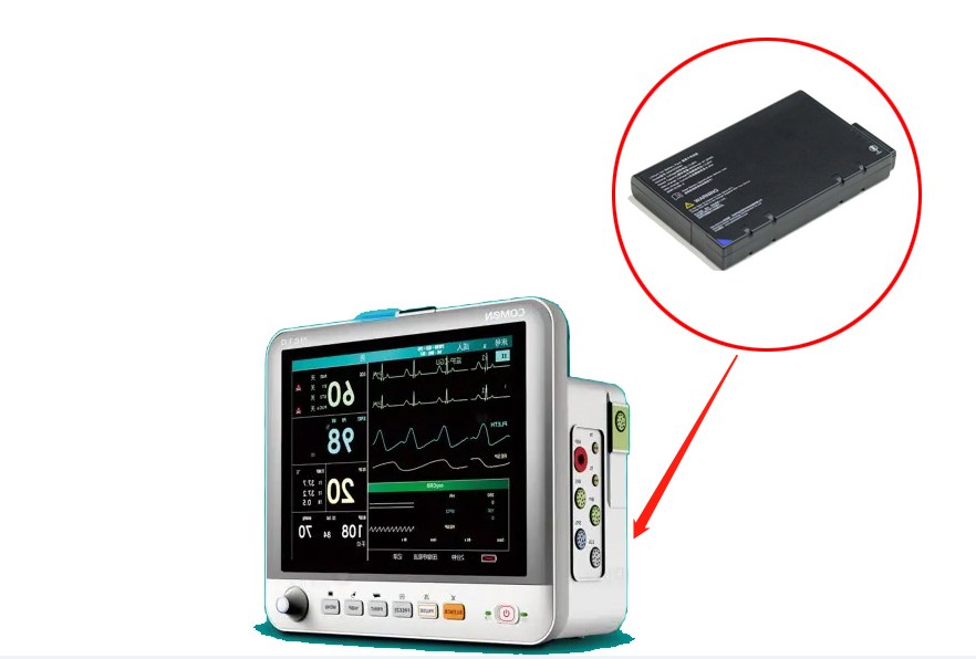 How to choose the battery of ECG monitor? - TEFOO